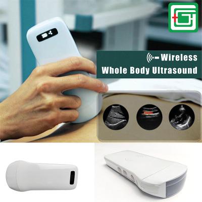 China 128 Elements Medical Hospital Equipments Color Doppler Portable Wireless Ultrasound Machine 3 In 1 for sale