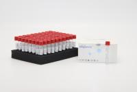 China Sample Release Reagent for PCR 80 Tubes per Box Nucleic Acid Extraction Free for sale