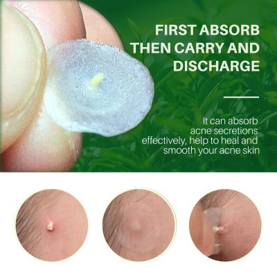 China Deleite impermeável orgânico da acne do anti remendo Hydrocolloid da espinha do enrugamento à venda