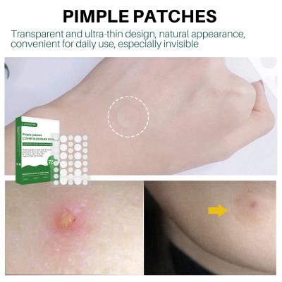 China Deleite impermeável orgânico da acne do anti remendo Hydrocolloid da espinha do enrugamento à venda