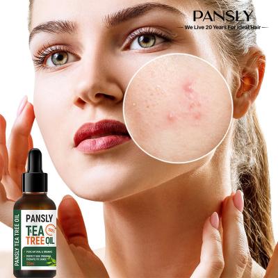 Cina 100% puro olio essenziale di melaleuca anti acne curativo incolore in vendita