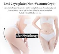 China Multifunctional Cryolipolysis Fat Freezing Machine With 8 Inch Touch Screen for sale