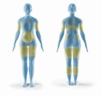 China Multifunctional Fat And Cellulite Reduction Machine With 8 Cryo Pads for sale