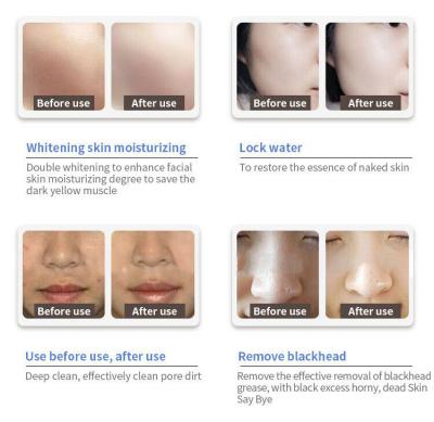 中国 1台のHydra Dermabrasionの小さい泡クリーニング機械H2O2表面皮に付き4台 販売のため
