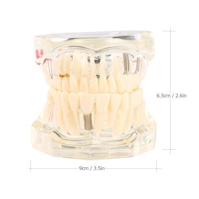Cina Modello di istruzione degli studenti di odontoiatria Standard per gli studi di odontoiatria Manuale di alimentazione 2 anni Durata di conservazione in vendita