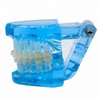 China Orthodontic Teeth Development Model CE Certified ALS Dental Teaching Models with Brackets for sale