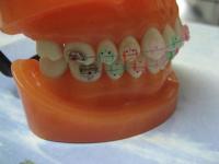China Orthodontic Teeth Development Model CE Certified ALS Dental Teaching Models with Brackets for sale