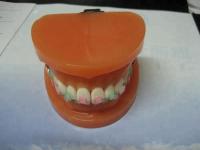 China Orthodontic Teeth Development Model CE Certified ALS Dental Teaching Models with Brackets for sale