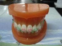 China Orthodontic Teeth Development Model CE Certified ALS Dental Teaching Models with Brackets for sale