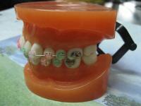 China Orthodontic Teeth Development Model CE Certified ALS Dental Teaching Models with Brackets for sale