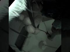 ZebraScope  4.8mm retroflxed rhinoscope