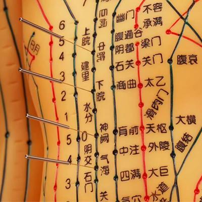 China Modèle de pratique des aiguilles d'acupuncture pour une formation sûre et précise for sale