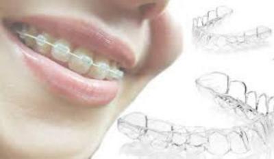 125MM Plastic Aligners PETG Sheets 0.6MM 0.75MM 1MM