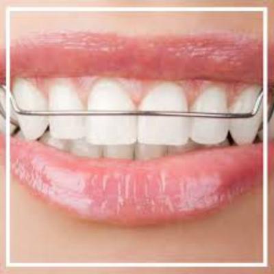 Cina strati di plastica trasparenti 7mm di 0.5mm 0.8mm 1.0mm 1.5mm 2mm 3mm 4mm 5mm 6mm PETG per l'apparecchio ortodontico in vendita