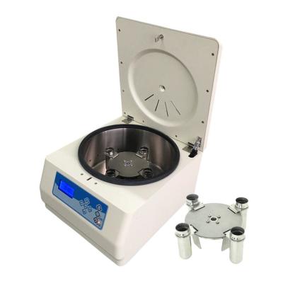 China L420 4200rpm Lab Centrifuge with 12x20ml Capacity Stainless Steel Rotor and Microprocessor Control for sale