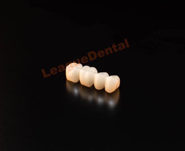 Quality Monolithic Restoration Lithium Disilicate Crown CAD Natural Full Contour for sale
