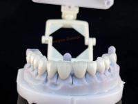 Quality 43%-46% Translucency PFZ Crown & Bridge Porcelain Fused To Zirconia Restorations for sale