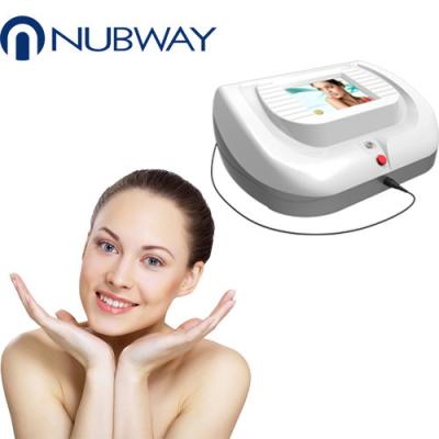 China IPL & RF Laser Spider Veins Removal 30mhz Beauty Machine For Salon for sale