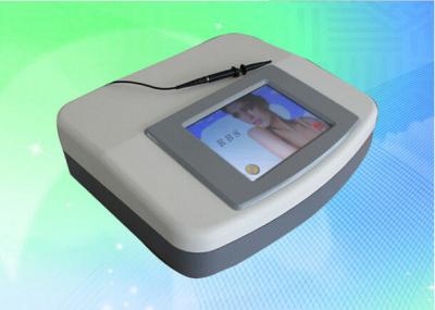 China 30mhz Spider Veins Removal Machine 150w / Vascular Lesions Removal for sale