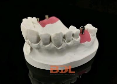 China Adaptable Bone Density TypeⅡ-Ⅳ Bone Dental Implant Bar Component For Dental Restoration for sale