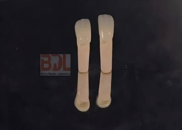 Quality High Fracture Toughness Ceramic Dentures with High Translucency and Low Thermal Conductivity for Dental Restorations for sale