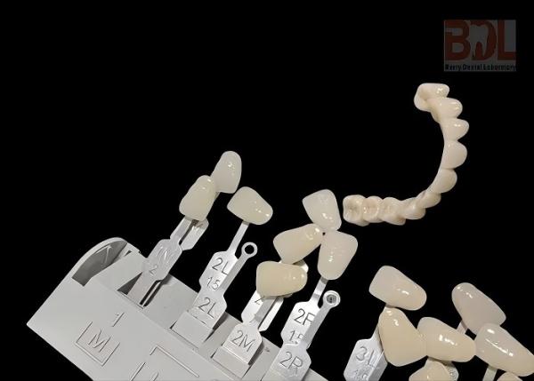 Quality Beige Matte Translucency Ceramic Dentures Providing Seamless Integration 400 for sale