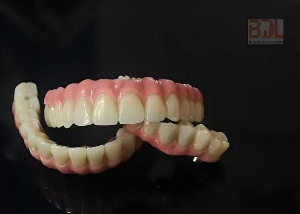 Quality Maloney Zirconia Bridge Implant Bar For Dental Restoration Custom No Foreign Body Sensation for sale