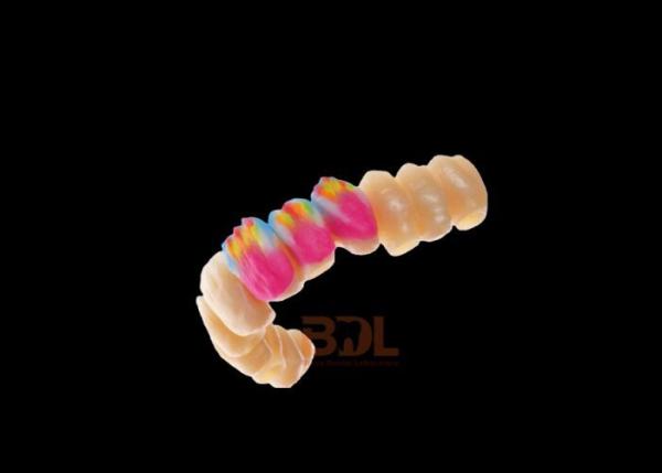 Quality High Precision Zirconia All Ceramic Crown With Transparent And Moist Color for sale