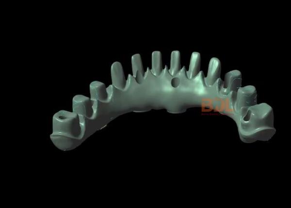 Quality 9mm 13mm 17mm  Dental Zirconia Bridge For Durable Dental Restoration for sale