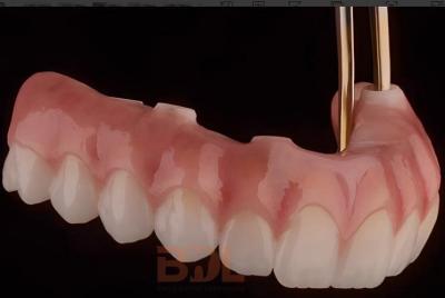 China Grade 5 Titanium Alloy Malong Bridge Implant Bar With Integrated Precision Machining for sale