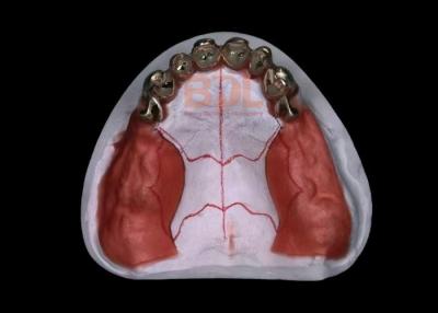 China Oral Restoration Integrated Precision Machining Dental Implant Solutions 9mm 13mm 17mm for sale