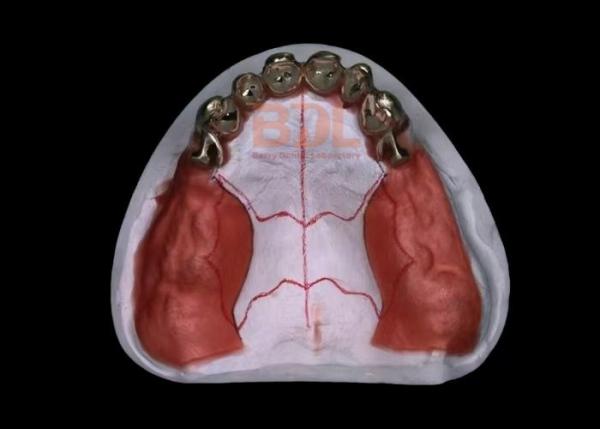 Quality Oral Restoration Integrated Precision Machining Dental Implant Solutions 9mm 13mm 17mm for sale