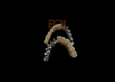 China Custom Manufactured 13mm Implant Bar For Optimal Bite Force Distribution for sale