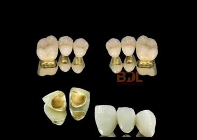 China Tooth Shade Matched PFM Crown Bridge Metal Alloy Base Porcelain Coating Precision for sale