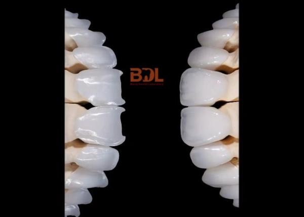 Quality Beige Matte Translucency Ceramic Dentures Providing Seamless Integration 400-600MPa for sale