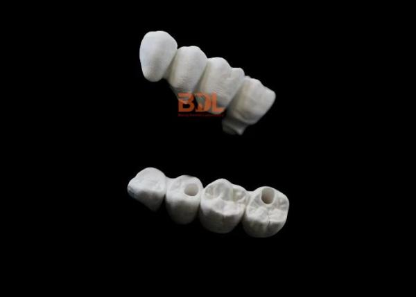 Quality Low Thermal Conductivity All Ceramic Dentures High Fracture Toughness Cementation for sale