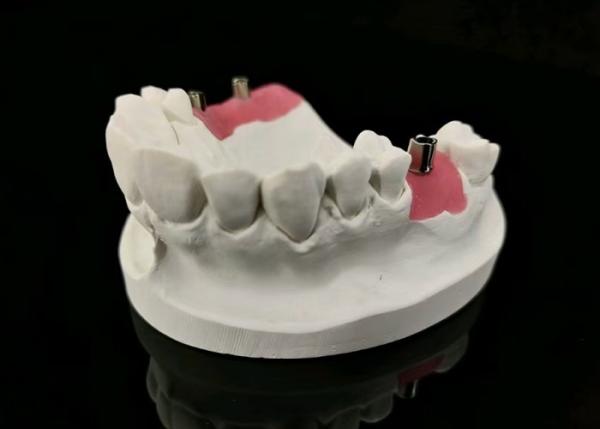 Quality CNC Precision Machining Custom Abutment Dental Implant For Missing One Or More for sale