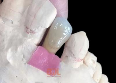 China CNC Precision Machining Dental Implant Bar Missing One Or More Teeth Ensuring Dental Care for sale