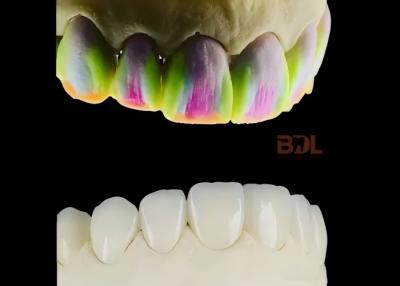 China Porcelain Emax Veneers With Cast Porcelain Ultra Thin Handmade Porcelain Stacking for sale
