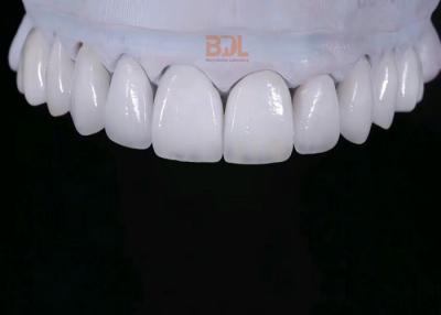 China Emax Dental Milling System Offering Sintering Temperature Approximately 850C-950C for sale