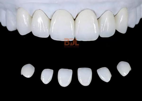 Quality Emax Dental Milling System Offering Sintering Temperature Approximately 850C for sale