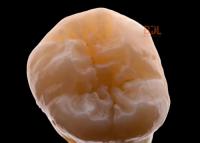 China Full Zirconia Ceramic Dentures High Precision Digital Production For Functional Restoration for sale