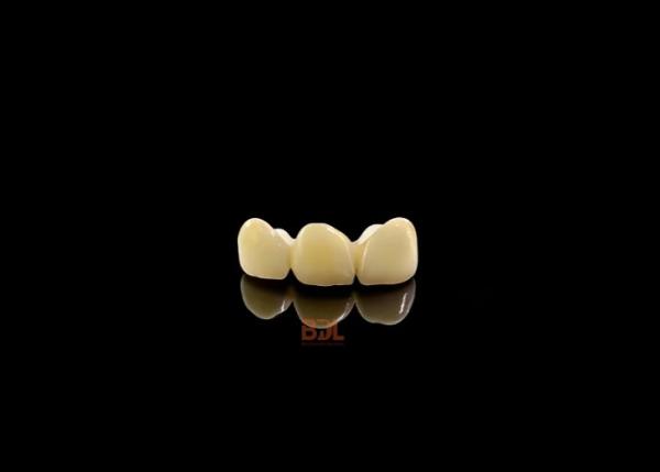 Quality Custom Made To Fit Individual Mouth Shape Translucency All Ceramic Crown Non Toxic for sale