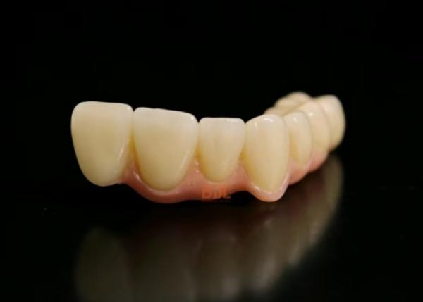 Quality Ceramic Dentures designed for anterior and posterior restorations providing fracture resistance and realistic appearance for sale