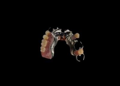 China Flexible Metal Framework Partial Dentures Expertly Designed Removable Dental Solutions Offering Stability and Durability for sale