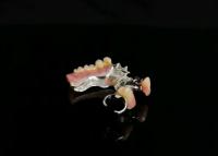 China Flexible Metal Framework Partial Dentures Expertly Designed Removable Dental Solutions Offering Stability and Durability for sale