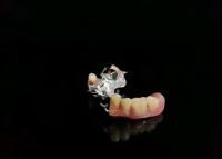 China Flexible Metal Framework Partial Dentures Expertly Designed Removable Dental Solutions Offering Stability and Durability for sale