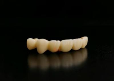 China Esthetic Zirconia Dental Bridge Featuring High Translucency and Robust Structure Perfect for Dental Restoration Projects for sale