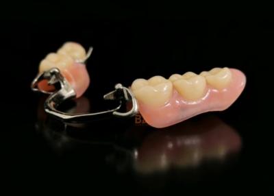 China Precision Metal Removable Partial Dentures Engineered for Accurate Fit and Performance in Dental Restoration Procedures for sale