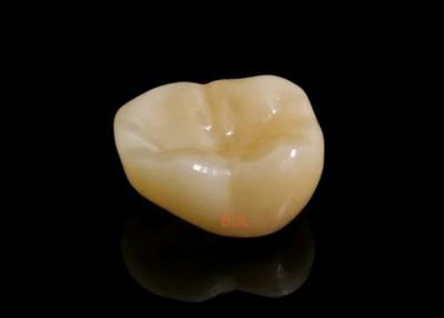 China Durable Ceramic Dental Prosthetics Designed to Meet Exacting Standards Providing Consistent and Patient Satisfaction for sale